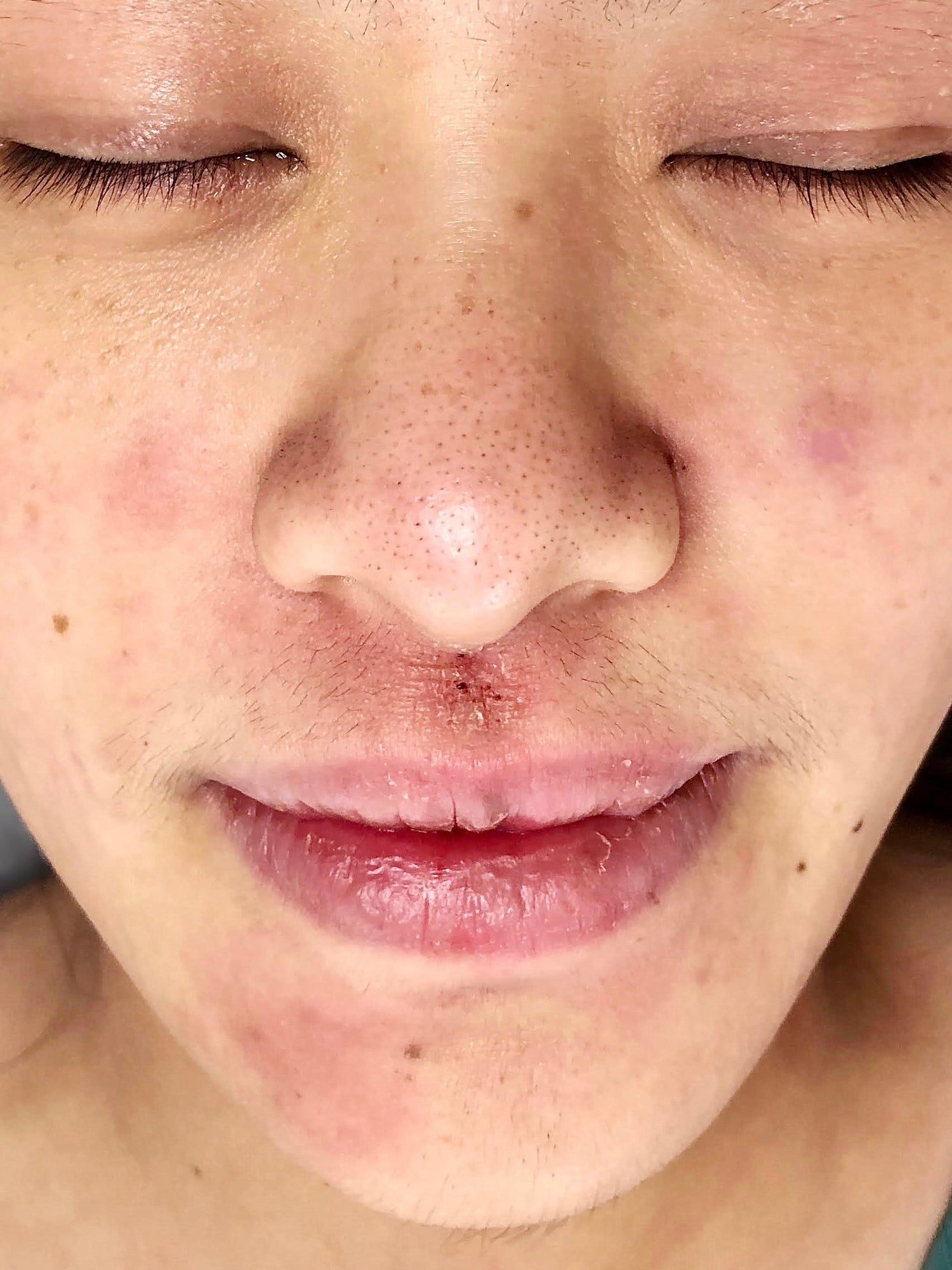 Mi:skn Clinic: Acne + Skin Experts in Perth – Mi Skn Clinic